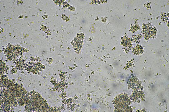 Poop Under Microscope Images – Browse 83 Stock Photos, Vectors, and ...