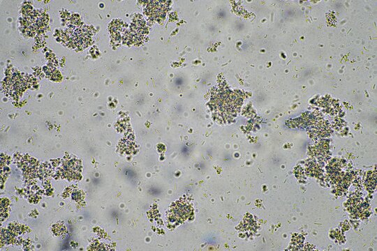 Poop Under Microscope Images – Browse 83 Stock Photos, Vectors, and ...