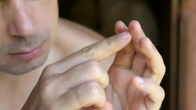 "Occupational Injury" Images – Browse 602 Stock Photos, Vectors, and ...