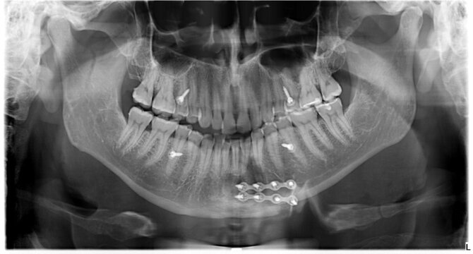 รูปภาพOpg – เลือกดูภาพถ่ายสต็อก เวกเตอร์ และวิดีโอ160 | Adobe Stock