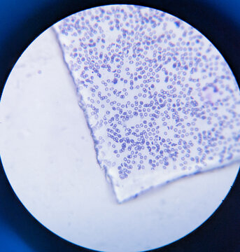 Smear Under Microscope Images – Browse 907 Stock Photos, Vectors, and ...