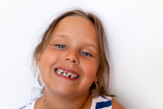 Milchgebiss Bilder – Durchsuchen 25,592 Archivfotos, Vektorgrafiken und ...