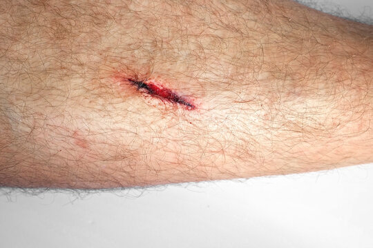 Obrázky Dehiscence – procházejte fotografie, vektory a videa 331 ...