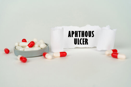 รูปภาพAphthous – เลือกดูภาพถ่ายสต็อก เวกเตอร์ และวิดีโอ361 | Adobe Stock