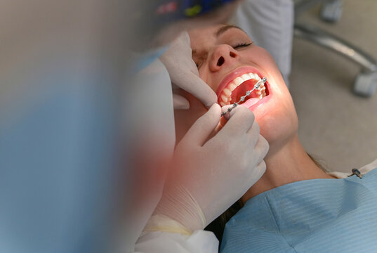 Imágenes De Orthodontic Descubre Bancos De Fotos Ilustraciones