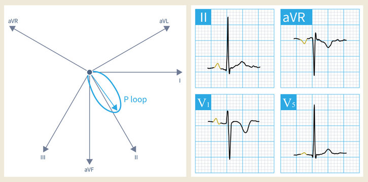 "P Waves" Images – Browse 499 Stock Photos, Vectors, and Video | Adobe ...