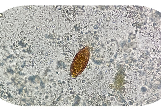 "Trichuris Trichiura" Images – Browse 885 Stock Photos, Vectors, and ...