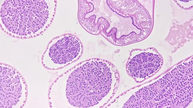 Poop Under Microscope Images – Browse 391 Stock Photos, Vectors, and ...