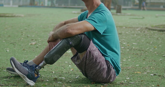 Imágenes de Amputar: descubre bancos de fotos, ilustraciones, vectores ...