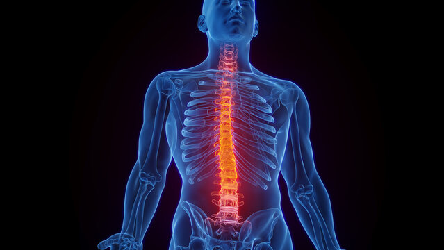 Spondylarthrose Bilder – Durchsuchen 463 Archivfotos, Vektorgrafiken ...