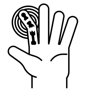 รูปภาพ"Broken Finger" – เลือกดูภาพถ่ายสต็อก เวกเตอร์ และวิดีโอ137 ...