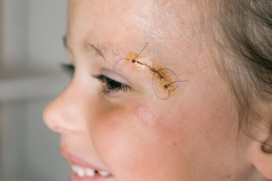 Stitches Images – Browse 444,434 Stock Photos, Vectors, and Video ...