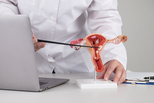 Darmpolypen Bilder – Durchsuchen 17,269 Archivfotos, Vektorgrafiken und ...