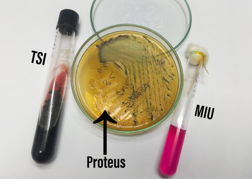 "Urine Culture" Images – Browse 175 Stock Photos, Vectors, and Video ...