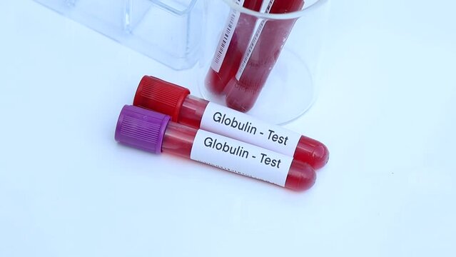 Globulin Images – Browse 519 Stock Photos, Vectors, and Video | Adobe Stock