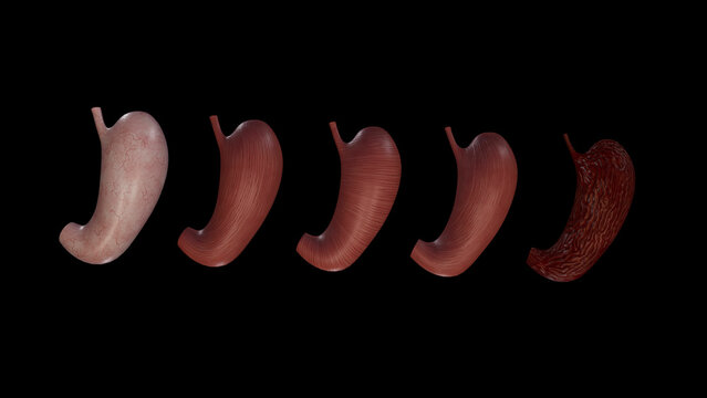 "Sigmoid Flexure" Billeder – Gennemse 499 stockfotos, vektorer og ...