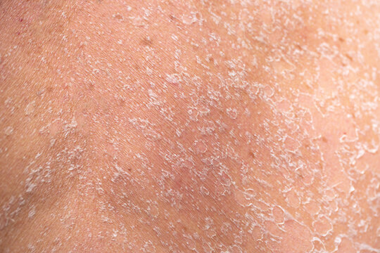 Imágenes de Erosionada: descubre bancos de fotos, ilustraciones ...