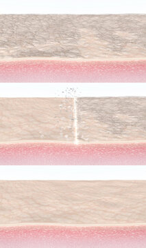 Impurities Images – Browse 30,877 Stock Photos, Vectors, and Video ...