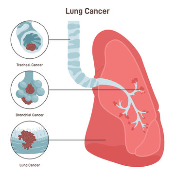 Windpipe Images – Browse 1,819 Stock Photos, Vectors, and Video | Adobe ...