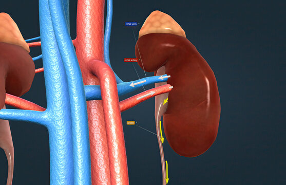 Nephrolithiasis Bilder – Durchsuchen 3,734 Archivfotos, Vektorgrafiken und Videos | Adobe Stock