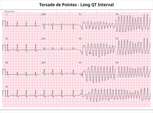 Torsades Imagens – Procure 463 fotos, vetores e vídeos | Adobe Stock