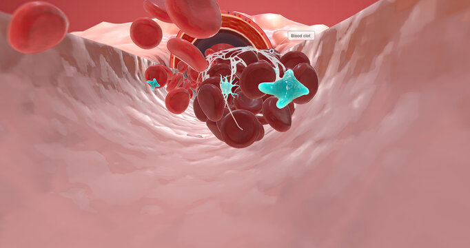 รูปภาพCoagulate – เลือกดูภาพถ่ายสต็อก เวกเตอร์ และวิดีโอ30,225 | Adobe ...