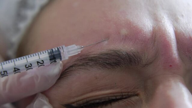"Botox Injection" Images – Browse 4,493 Stock Photos, Vectors, and ...