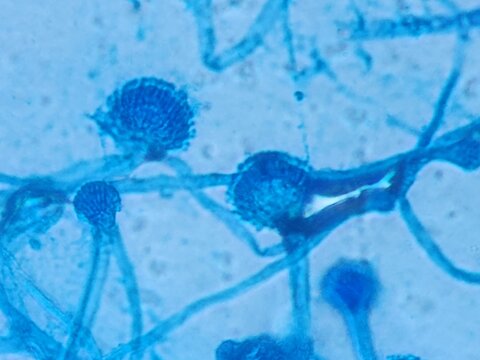 Conidiophore bilder – Bläddra bland 1,528 stockfoton, vektorer och ...