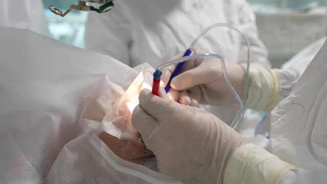 "Cataract Surgery" Images – Browse 901 Stock Photos, Vectors, and Video ...