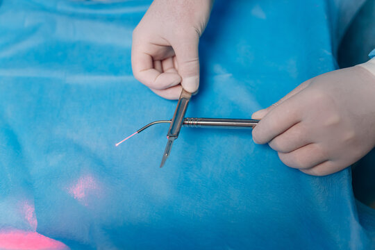 Anoscopy Images – Browse 177 Stock Photos, Vectors, and Video | Adobe Stock