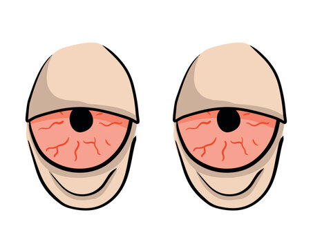Tired Red Eyes Cartoon