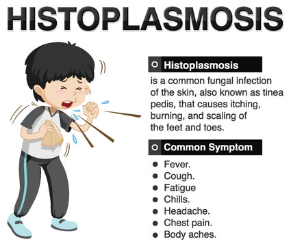 Histoplasmosis