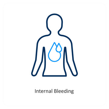 "Internal Bleeding" Images – Browse 435 Stock Photos, Vectors, and ...
