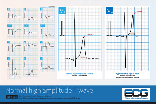 "Middle-Aged Men" Imagens – Procure 1,974 fotos, vetores e vídeos | Adobe Stock
