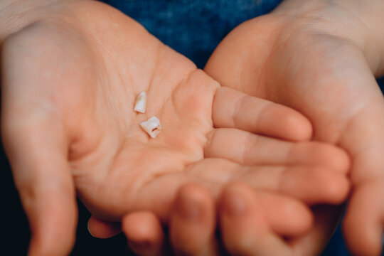 Milchgebiss Bilder – Durchsuchen 25,592 Archivfotos, Vektorgrafiken und ...