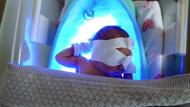 Imágenes de Phototherapy: descubre bancos de fotos, ilustraciones ...