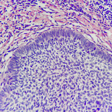 Basaliom Bilder – Durchsuchen 615 Archivfotos, Vektorgrafiken und ...