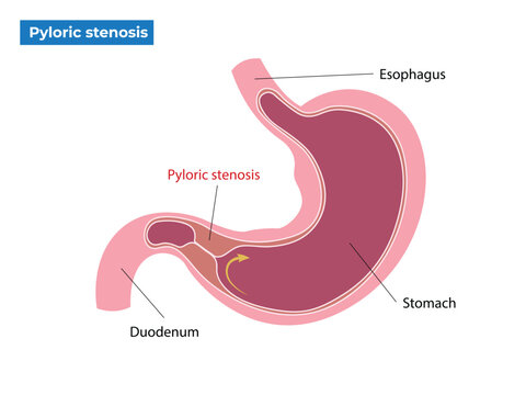 Pylorus Of Stomach