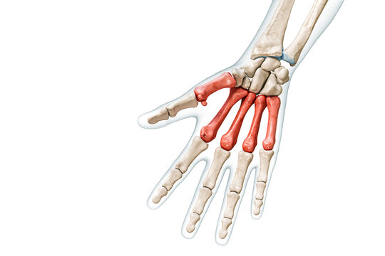 Metacarpals Bone