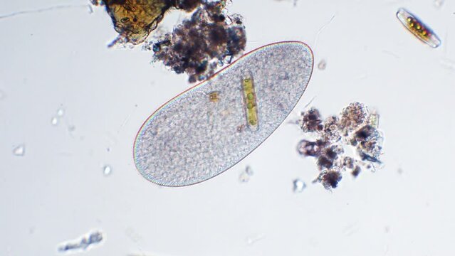 Spirostomum Under Microscope 400x