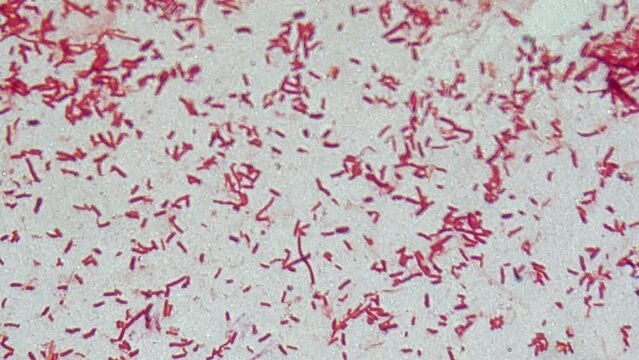 Is Citrobacter Freundii Gram Positive Or Negative