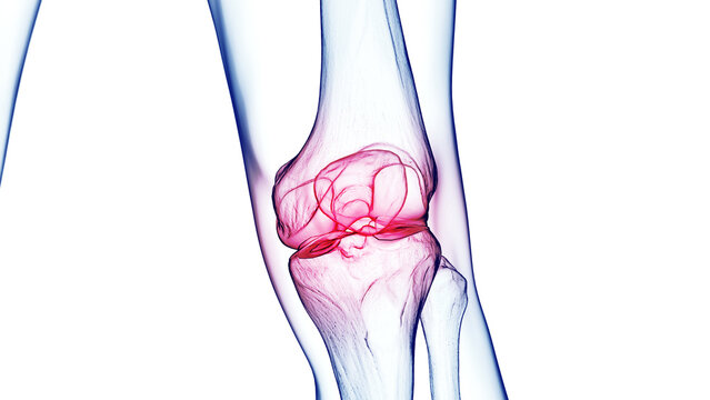 Podagra Bilder – Durchsuchen 44,351 Archivfotos, Vektorgrafiken und ...