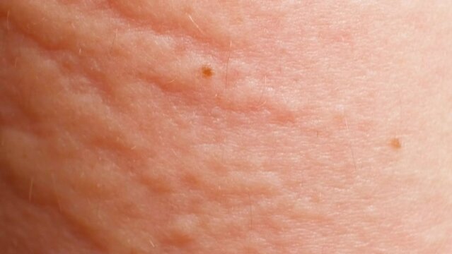 Giardia-Bilder: Stock-Fotos & -Videos. | Adobe Stock