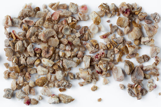 Afbeeldingen over "Kidney Stone" – Blader in stockfoto's, vectoren en ...