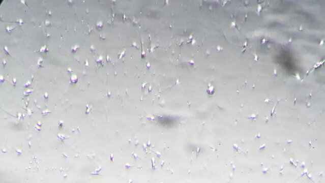 Spermogram bilder – Bläddra bland 306 stockfoton, vektorer och videor ...