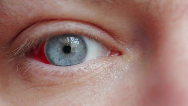 Imágenes de Blue(Bruise): descubre bancos de fotos, ilustraciones ...