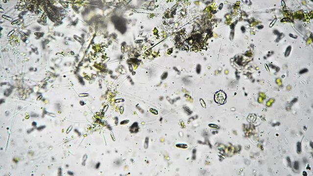 Infusoria Images – Parcourir 1,254 le catalogue de photos, vecteurs et ...