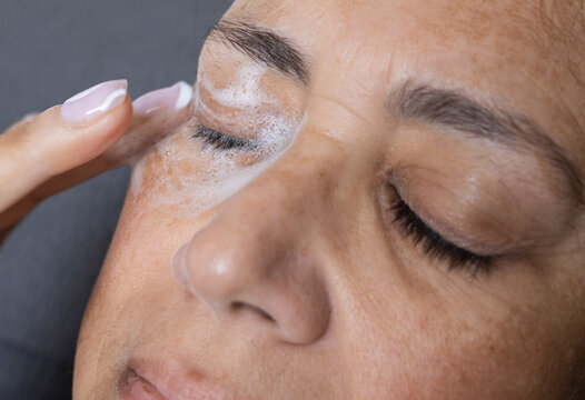 Blefarit bilder – Bläddra bland 1,125 stockfoton, vektorer och videor ...