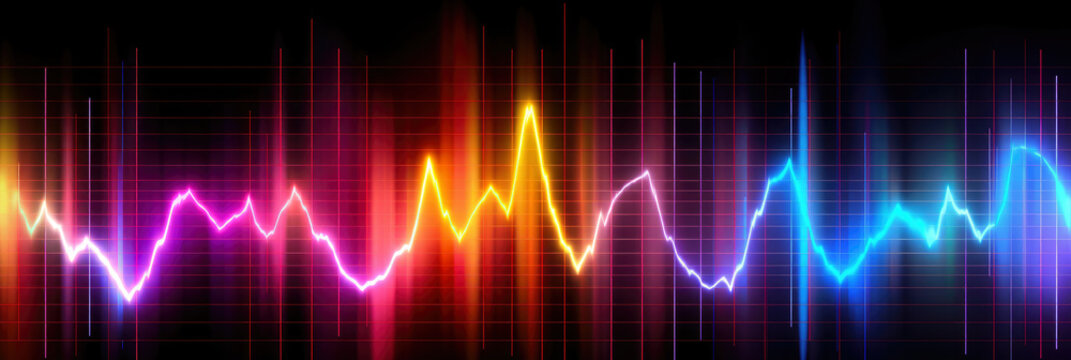 Music Heartbeat Staff