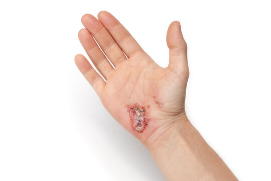 Hand.stitch bilder – Bläddra bland 65,815 stockfoton, vektorer och ...